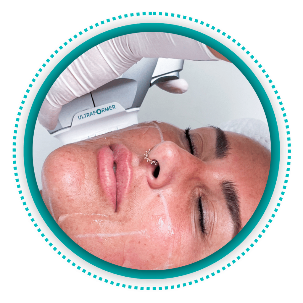 Ultraformer III - Pró Estética