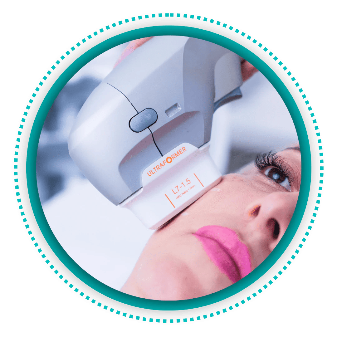 Ultraformer III - Pró Estética